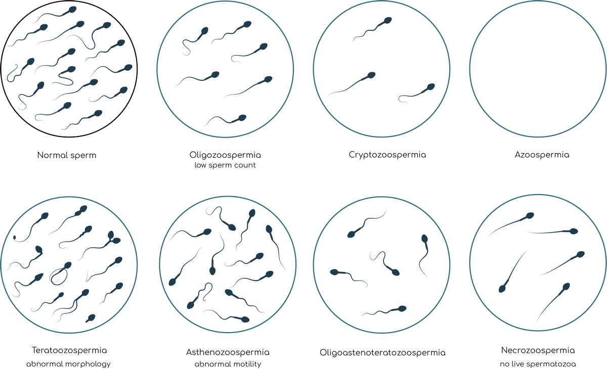 Dijagnostičke pretrage - spermiogram.hr